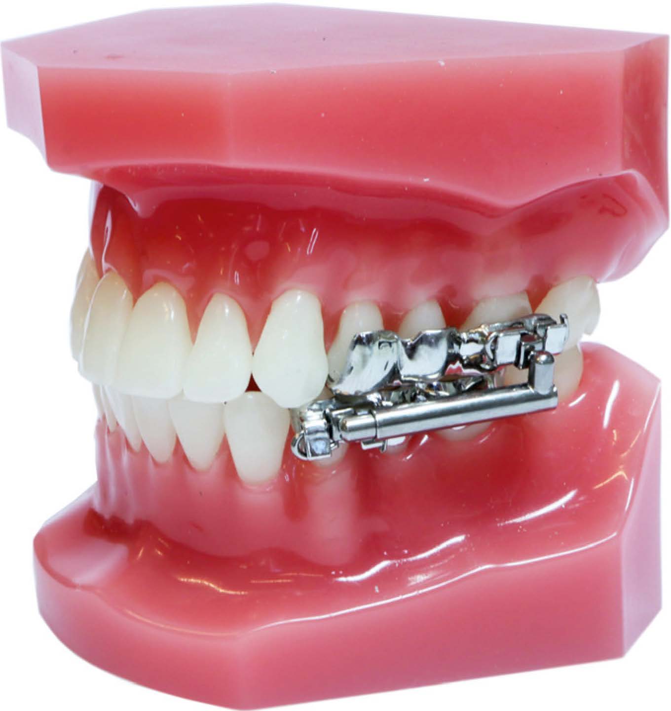 BBC-Orthotec | High-quality products for orthodontics and sleep medicine.